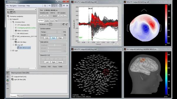 『脑机接口BCI资源合集』软件篇 —— 为你匹配最适合的BCI分析软件 - 知乎