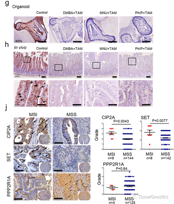 Nature Communications|蛋白磷酸酶2A（PP2A）或将成为肿瘤生物标志物“新宠” - 知乎