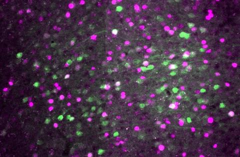 ImageJ实用教程汇总 - 知乎