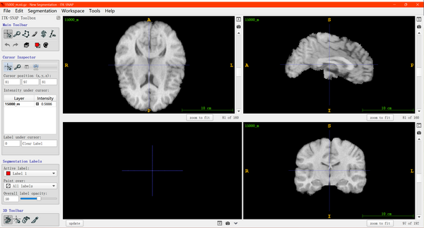 [论文笔记] VoxelMorph - 知乎