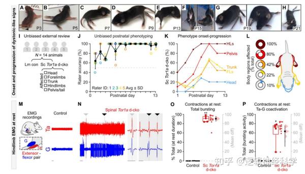 STM︱伦敦大学学院团队发现脊髓神经回路功能障碍介导的Dyt1-Tor1a肌张力障碍小鼠的病理发生机制 - 知乎