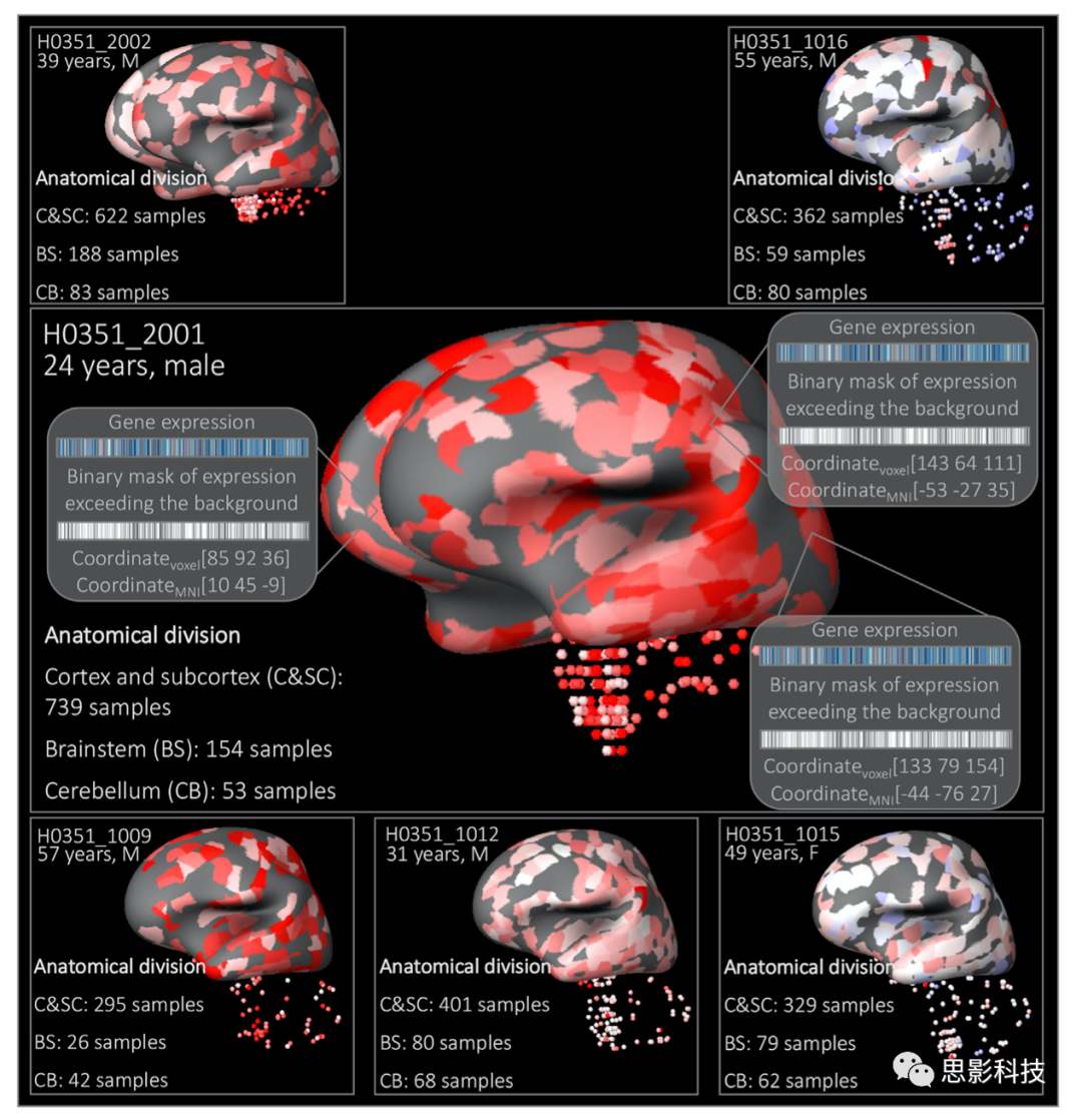 全脑基因表达和神经影像数据关联指南 - 知乎