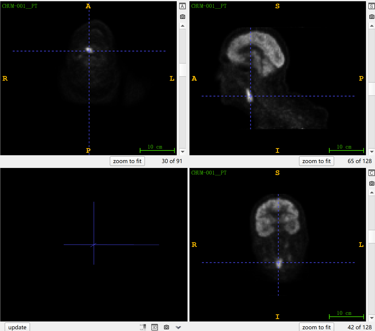 HECKTOR 2022 数据集介绍 - 知乎
