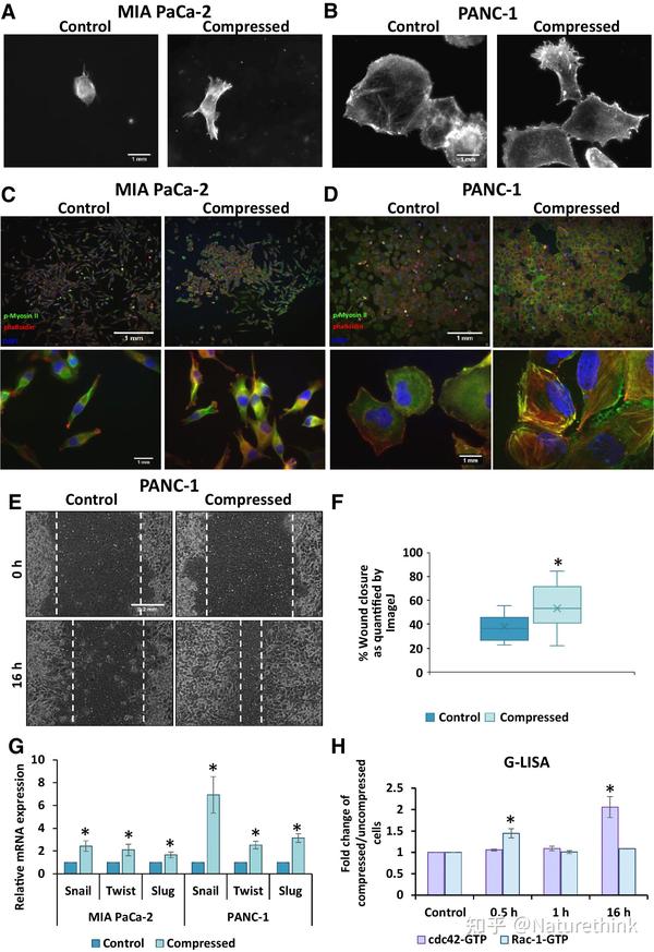 胰腺癌细胞中的机械应力信号触发p38 MAPK和JNK依赖性细胞骨架重塑，并通过Rac1 / cdc42 / 肌球蛋白II促进细胞迁移 - 知乎