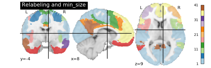 nilearn 笔记（15） - 知乎