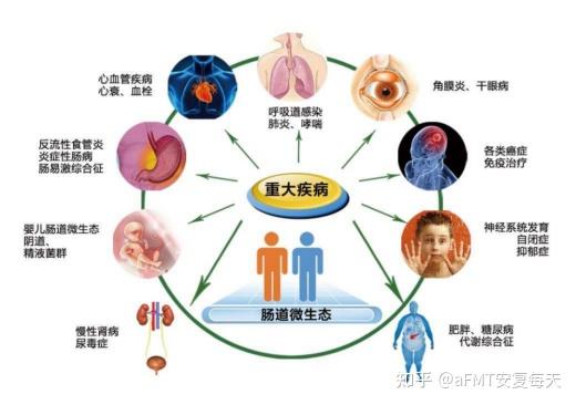 菌群移植是什么，一文带你了解FMT！ - 知乎