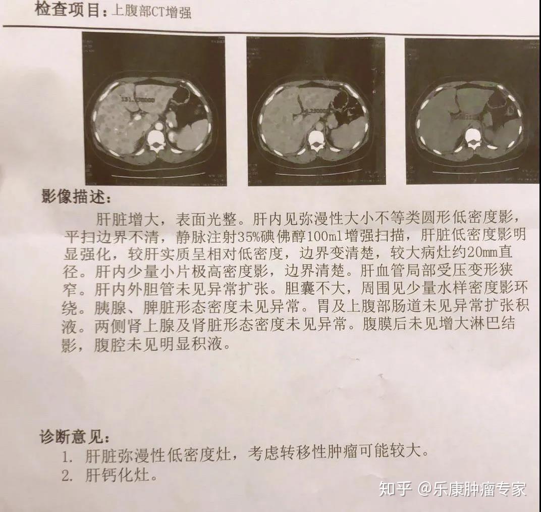 CT报告看不懂咋办？这份检查教你快速看懂！ - 知乎