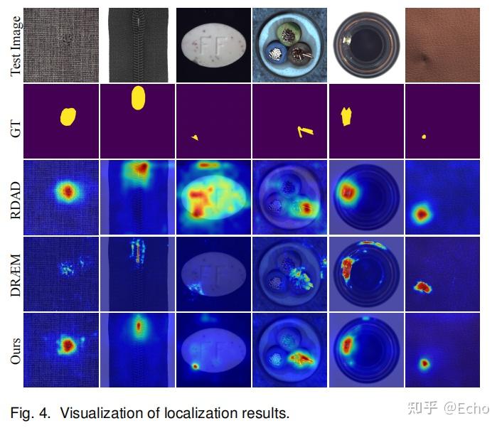 A Discrepancy Aware Framework for Robust Anomaly Detection（差异感知框架致力于鲁棒的 ...