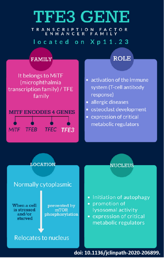 与肿瘤相关的那些明星基因：肾癌之TFE3 - 知乎
