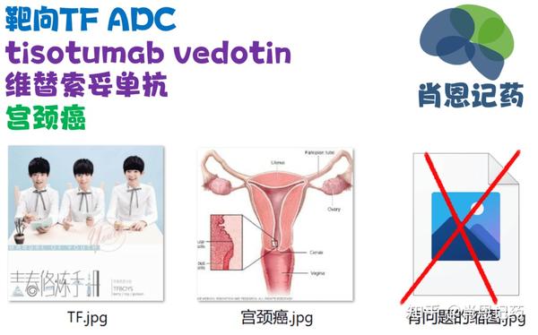 记住所有FDA生物药 | 靶向TF ADC | TIVDAK® tisotumab vedotin 维替索妥单抗 | 宫颈癌 - 知乎