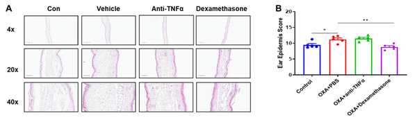 迟发性超敏反应（DTH）疾病模型 - 知乎