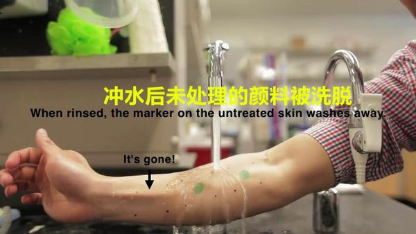 Rox Anderson：从激光医学之父到最成功的医生创业者 - 知乎