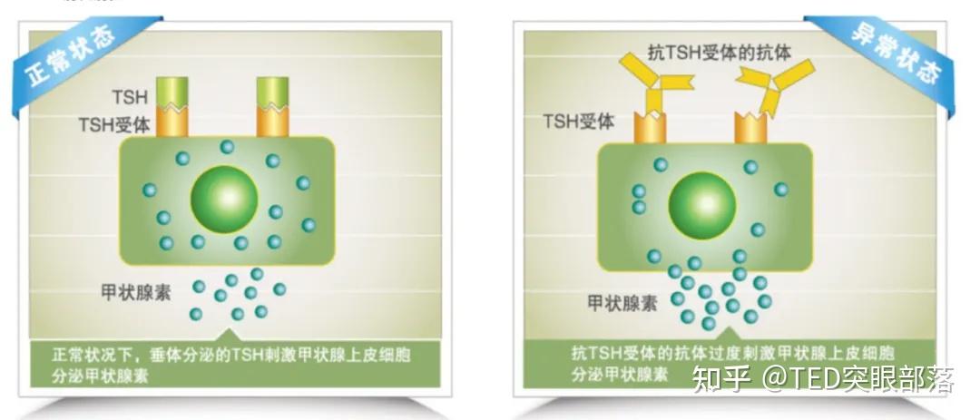 揭秘TRAb | 什么是TRAb？如何降TRAb？ - 知乎