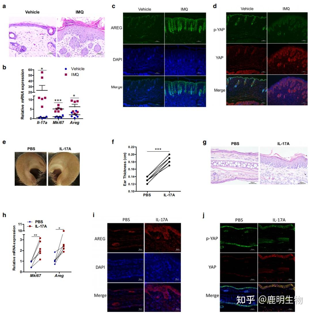 运用转录组学揭示银屑病细胞因子 IL-17A 促进表皮增厚 - 知乎