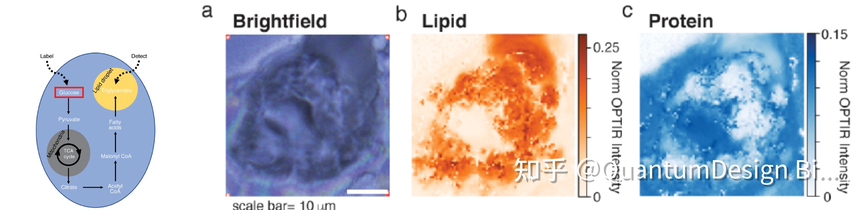 耶鲁大学新进展！探索活细胞脂肪代谢过程：光学红外显微成像技术揭开DNL的奥秘 - 知乎