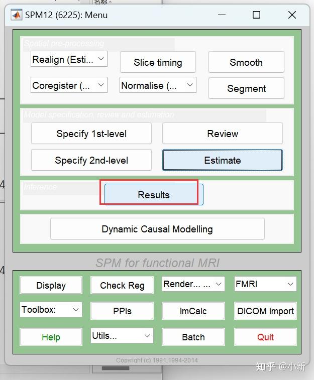 8-SPM-fmri任务态 二阶分析： 单样本t检验 - 知乎