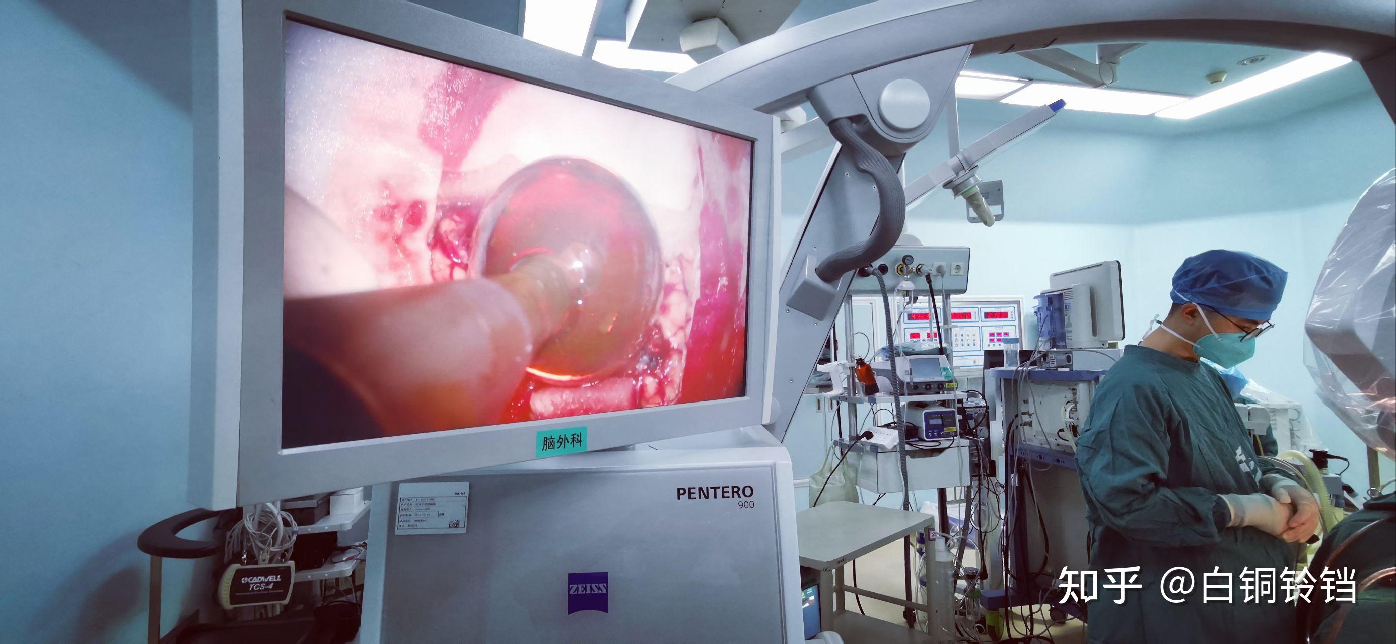 肿瘤的近距离治疗（蔡司INTRABEAM IORT） - 知乎