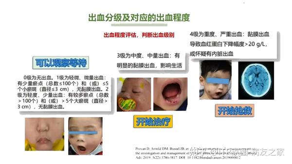 一问医答 | 原发免疫性血小板减少症（ITP）常见问题（四） - 知乎