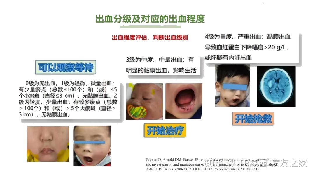 一问医答 原发免疫性血小板减少症（itp）常见问题（四） 知乎