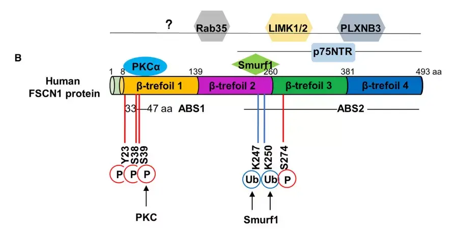 杰享第08期：肌动蛋白结合蛋白1（FSCN1）:潜力生物标志物及药物开发靶点？ - 知乎