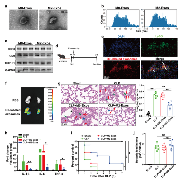 生物医学杂志丨IF：11丨M2巨噬细胞外泌体 通过抑制中性粒细胞NETs从而减轻脓毒症损伤 - 知乎