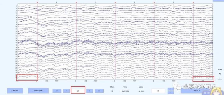 干货分享 | 如何使用eeglab画出理想的脑电图 - 知乎