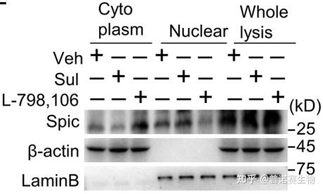 文献解读 | J Exp Med发现NK细胞抑制肝纤维化的作用及机制 - 知乎