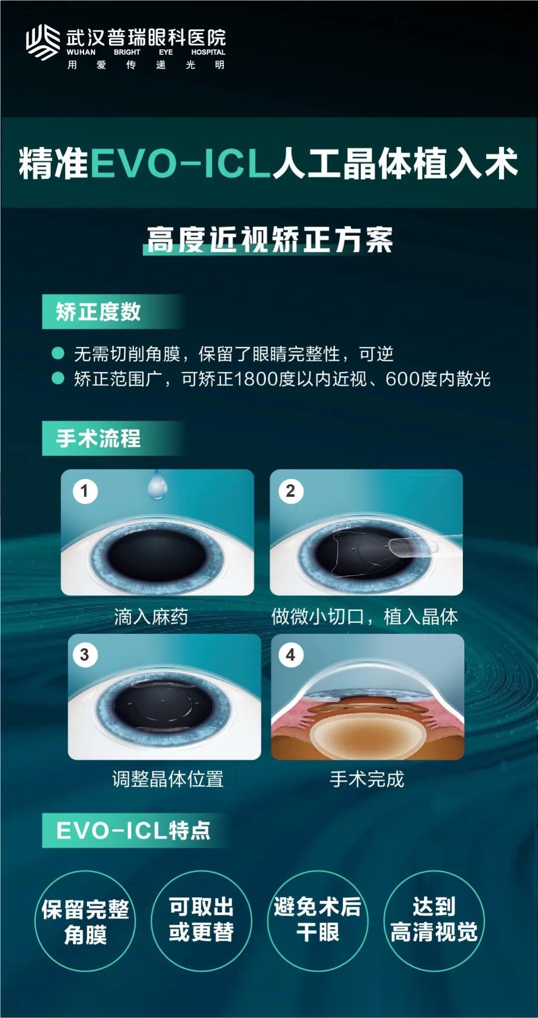 武汉普瑞眼科举办ICL专家见面会 谢娇获全球EVO ICL 认证医师证书 - 知乎