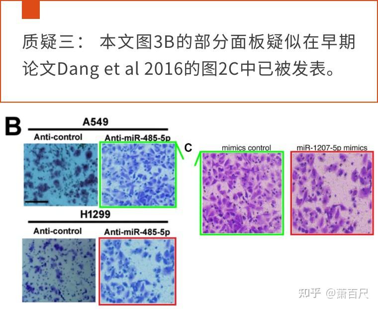 苏州大学附属第一医院的论文多图被读者发现已在早期论文发表 - 知乎