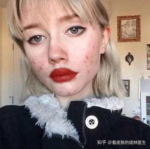 告别换季危“肌”！口罩脸的护肤公式，抓紧来一套！ - 知乎