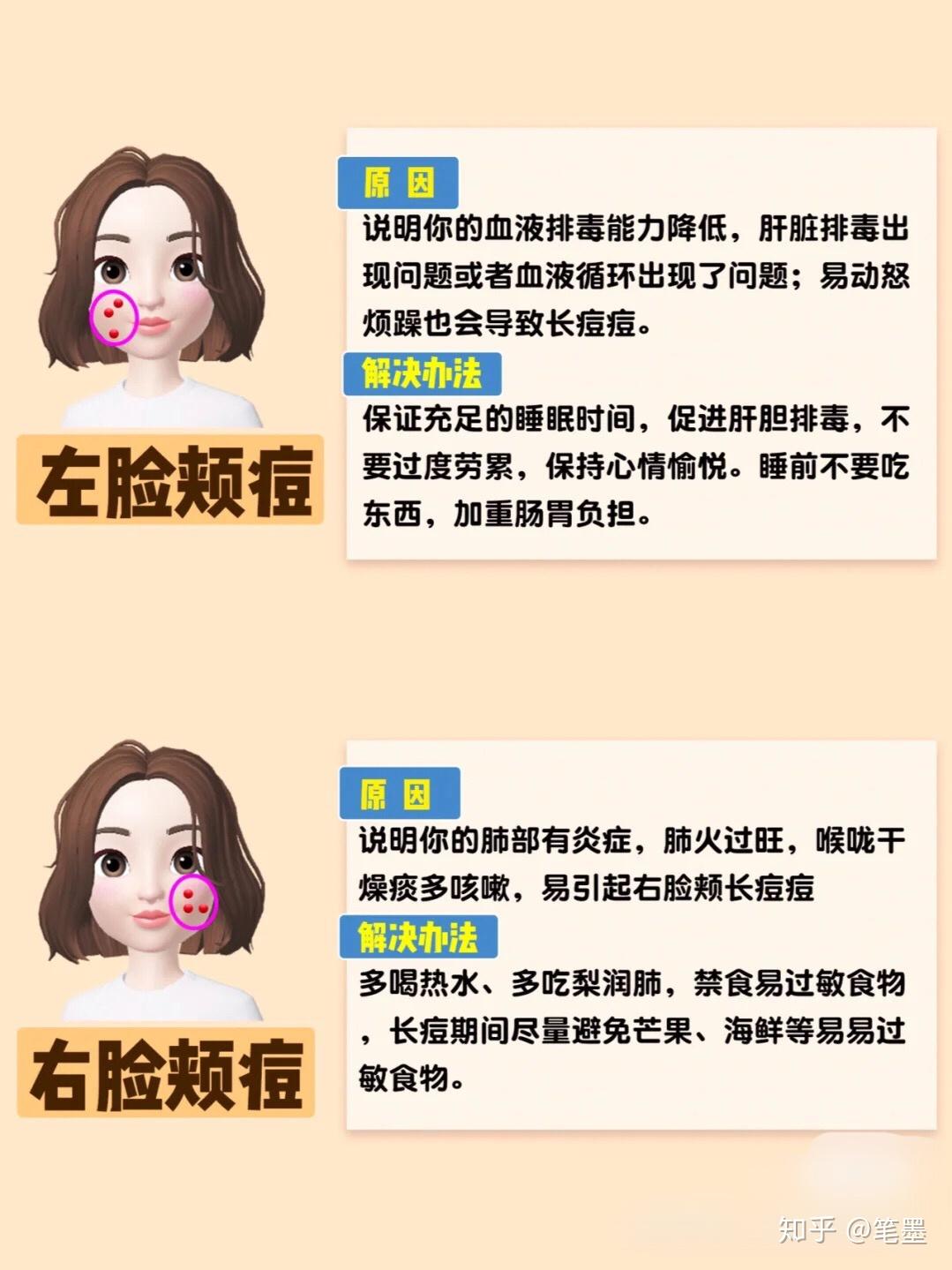 干货|剖析长痘痘原因！和痘痘say bye bye - 知乎