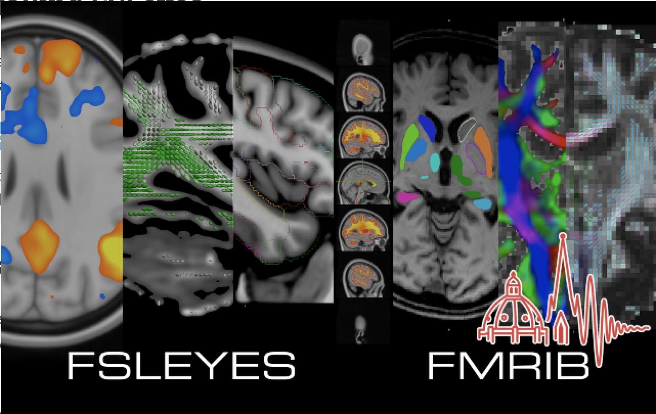fsleyes -- 一款多功能影像数据查看器 - 知乎