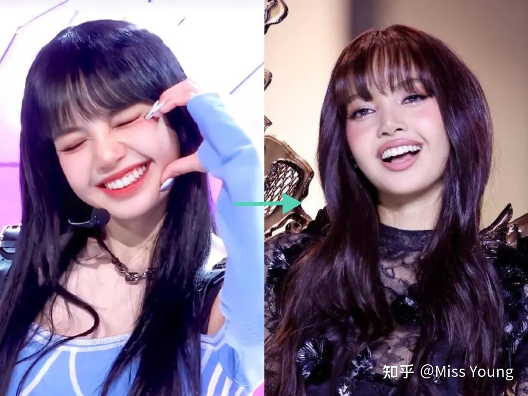 Lisa这脸是打了贴骨针的反面教材吧… - 知乎