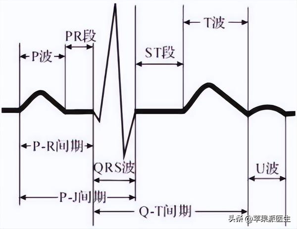 心电图判读（1）：基础知识 - 知乎