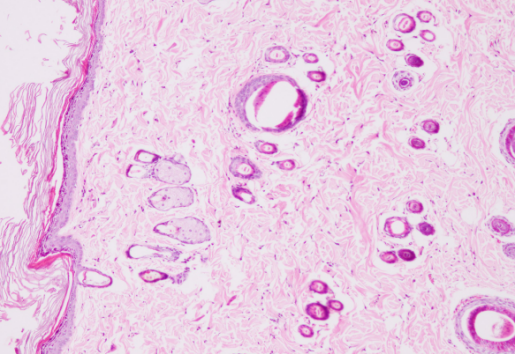 小鼠心肌纤维化调控机制影响肥厚型心肌病方案设计分享——Apelin-13/Sphk1/S1P/Rho - 知乎