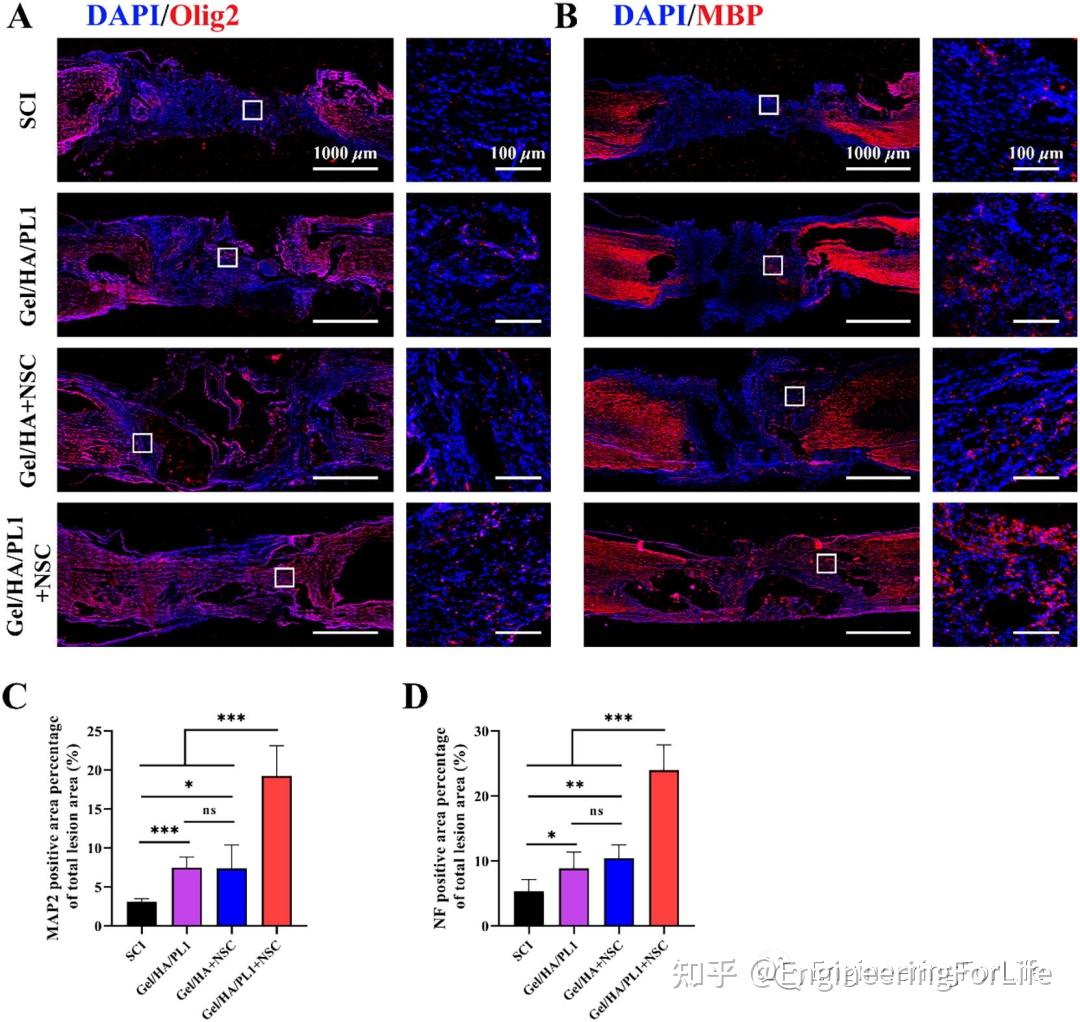 《Chem. Eng. J.》：3D打印导电脊髓仿生支架--促进神经干细胞神经元分化和脊髓修复 - 知乎
