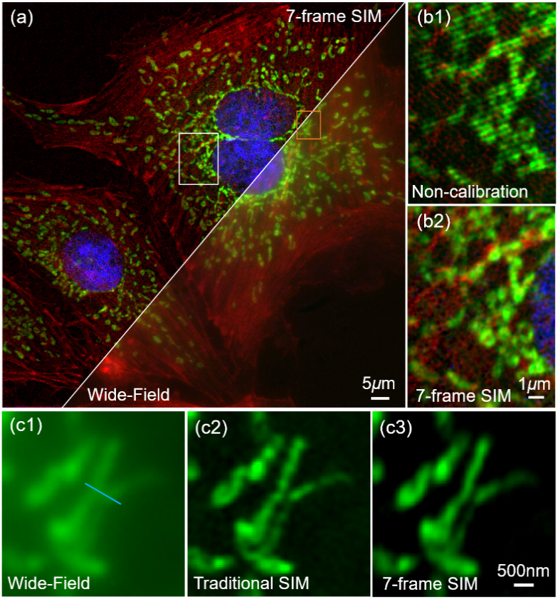 南京理工大学智能计算成像实验室左超教授团队：基于加速互相关参数估计的少帧结构光照明显微成像技术 - 知乎