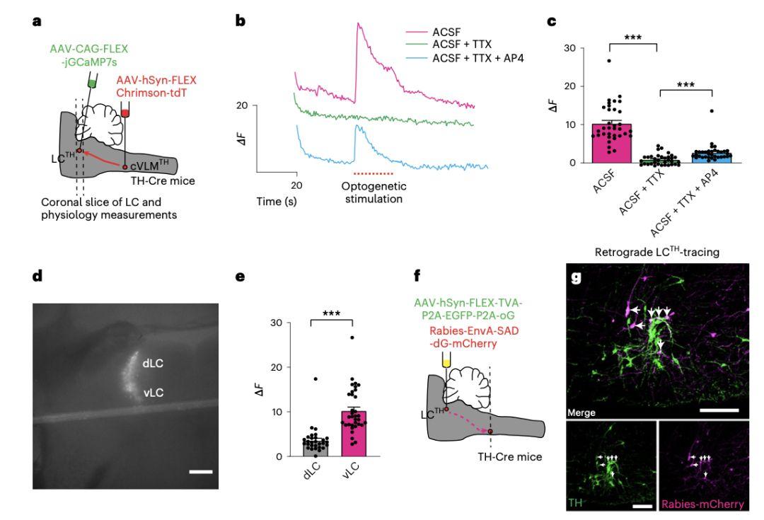 Nature Neurosci：疼痛调控新神经环路 - 知乎