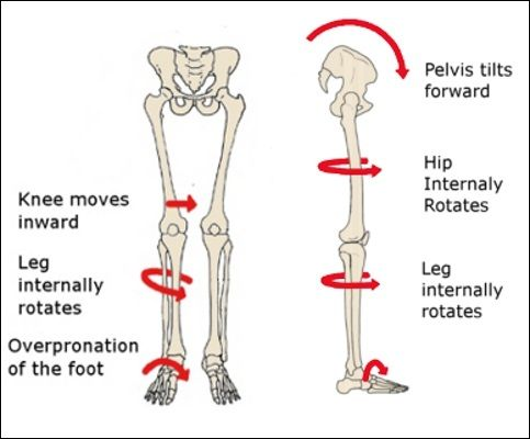 怎么练腿部力量治疗膝盖疼？ - 知乎