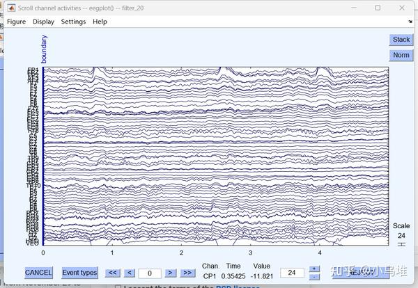 MATLAB医学信号处理2 （eeglab的保姆级教程） - 知乎