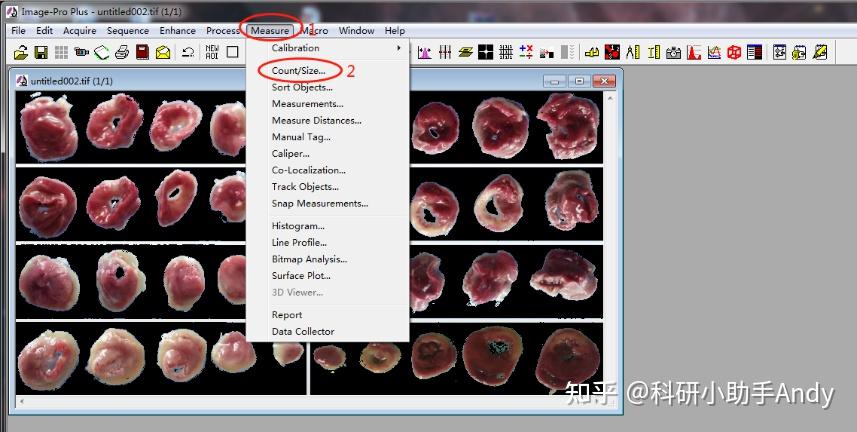 TTC染色详细计算分析过程，步骤详解（组图） - 知乎