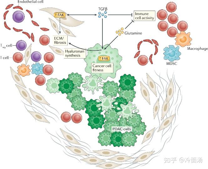The tumor microenvironment in pancreatic cancer — clinical challenges ...