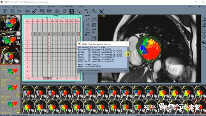 4D-Flow扫描数据采集：序列及参数 - 知乎