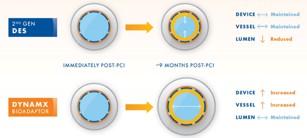 DynamX生物适配器：安全性与有效性 - 知乎