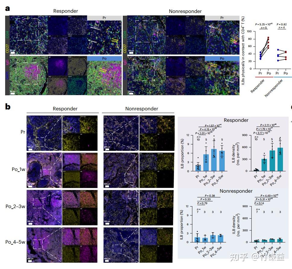 【转化医学研究】鼻咽癌吉西他滨加顺铂治疗后的肿瘤免疫微环境 - 知乎