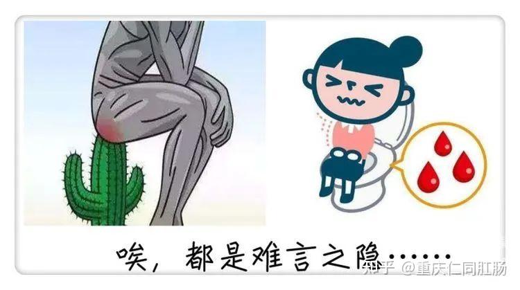 重庆肛肠医院春节将至，注意以下几点，防止肛肠疾病发生 知乎 3883