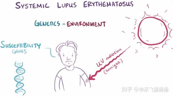 医学科普之系统性红斑狼疮SLE - 知乎