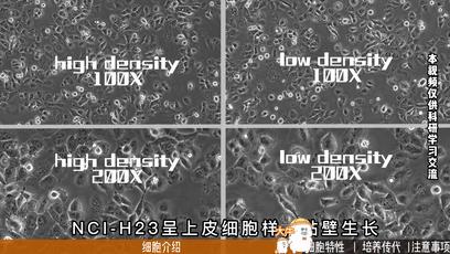 NCI-H23细胞培养，人非小细胞肺癌细胞培养攻略 - 丰晖生物 - 知乎