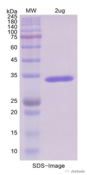 IdeSProtease：特异性切割IgG，一个挑剔的工具酶 - 知乎