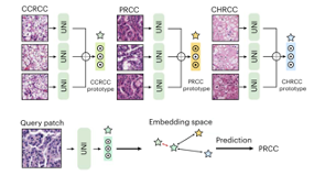 Nature Medicine｜Towards a general-purpose foundation model for computational pathology 论文分享 - 知乎
